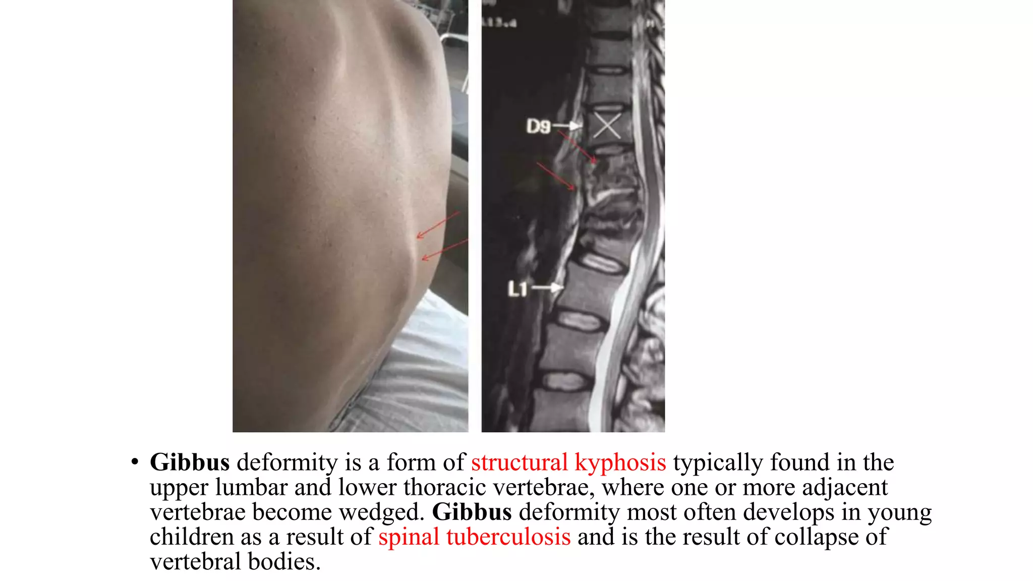 MUSCULOSKELETAL EXAMINATION Y3.pptx