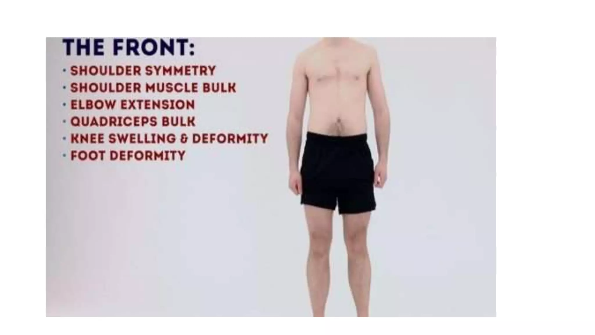 MUSCULOSKELETAL EXAMINATION Y3.pptx