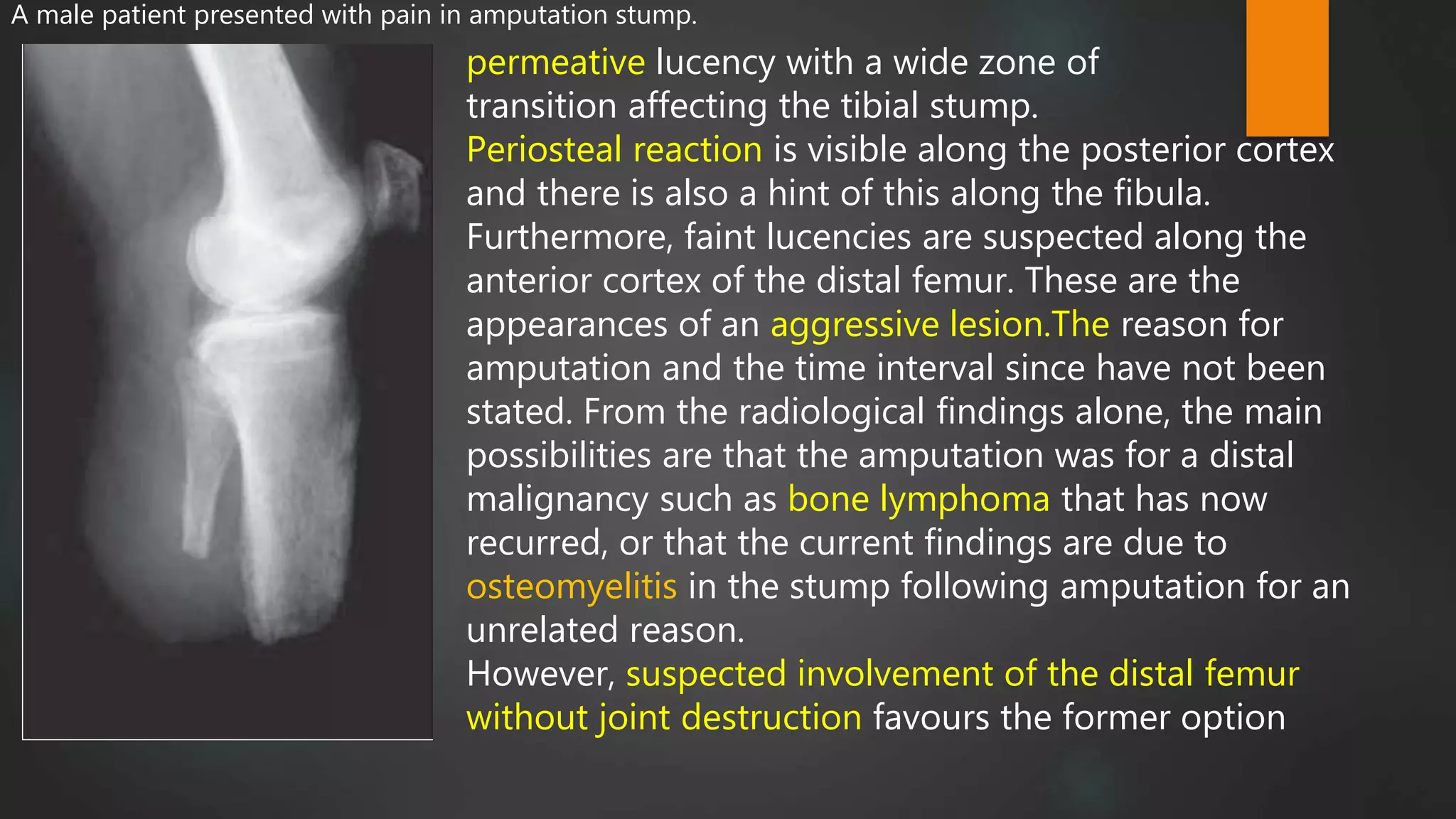 Musculoskeletal imaging rapid review of radiology | PPTX