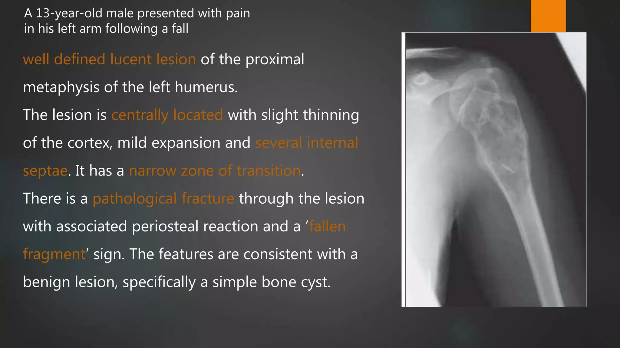 Musculoskeletal imaging rapid review of radiology | PPTX