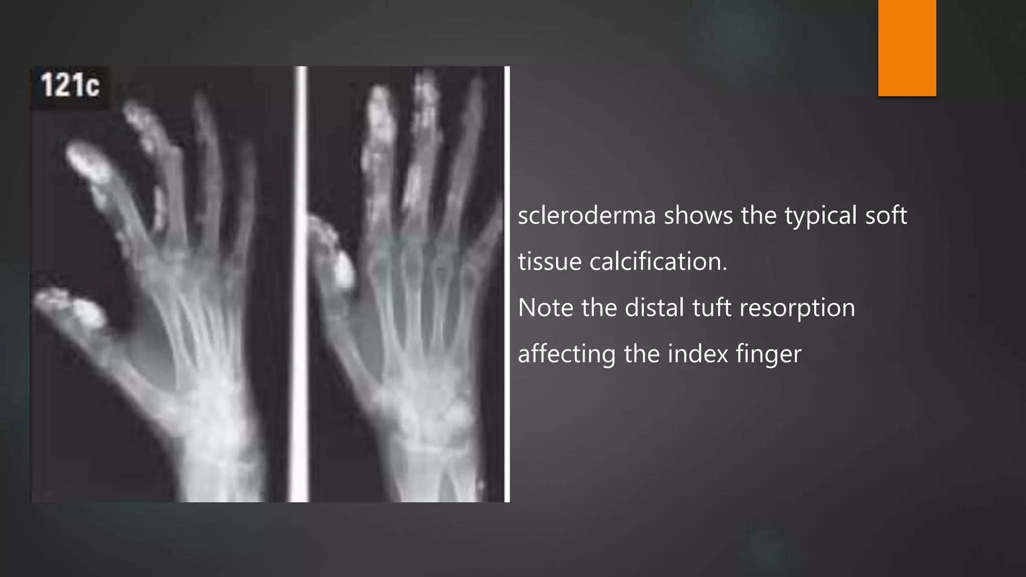 Musculoskeletal imaging rapid review of radiology | PPTX