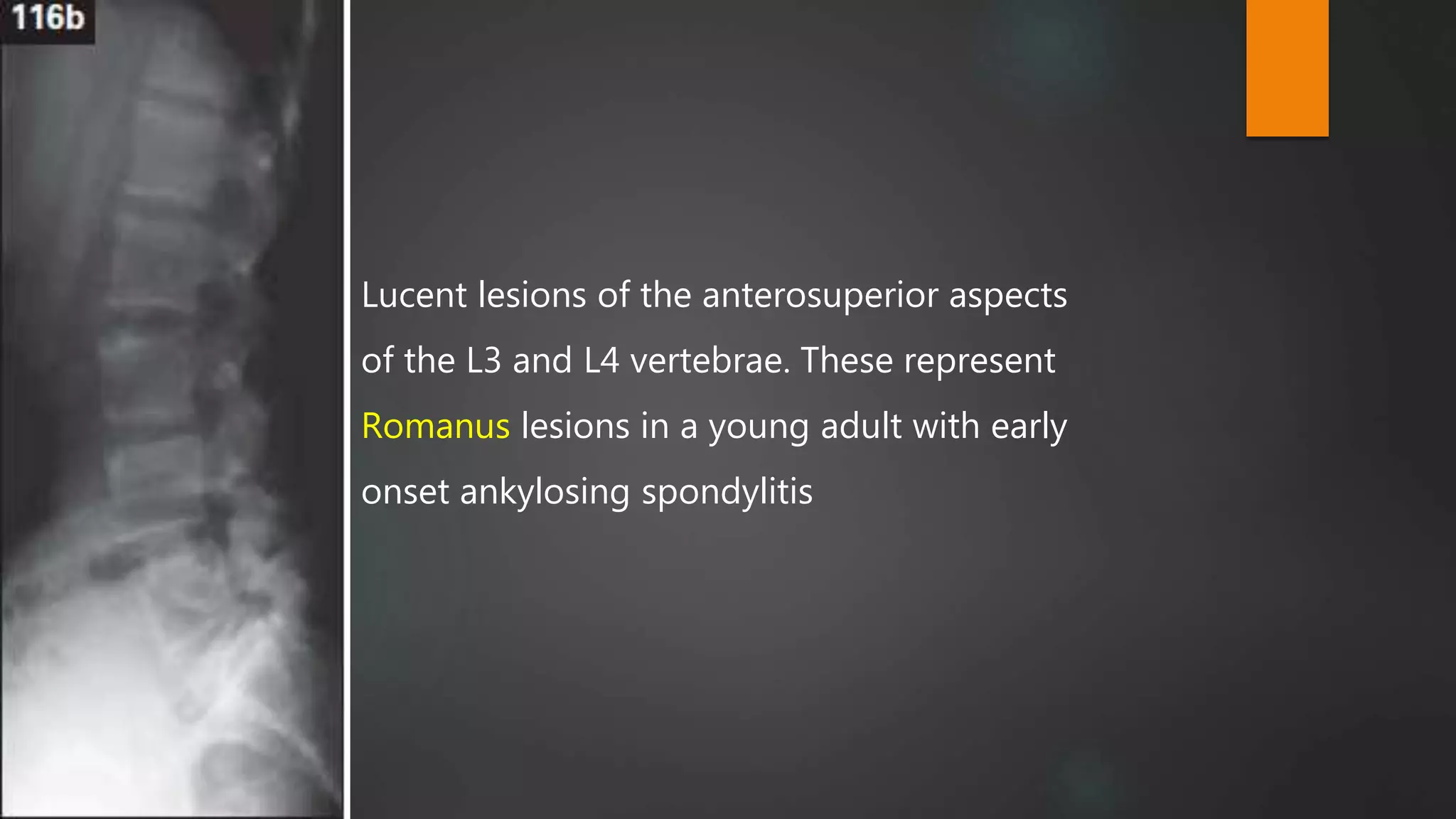 Musculoskeletal imaging rapid review of radiology | PPTX