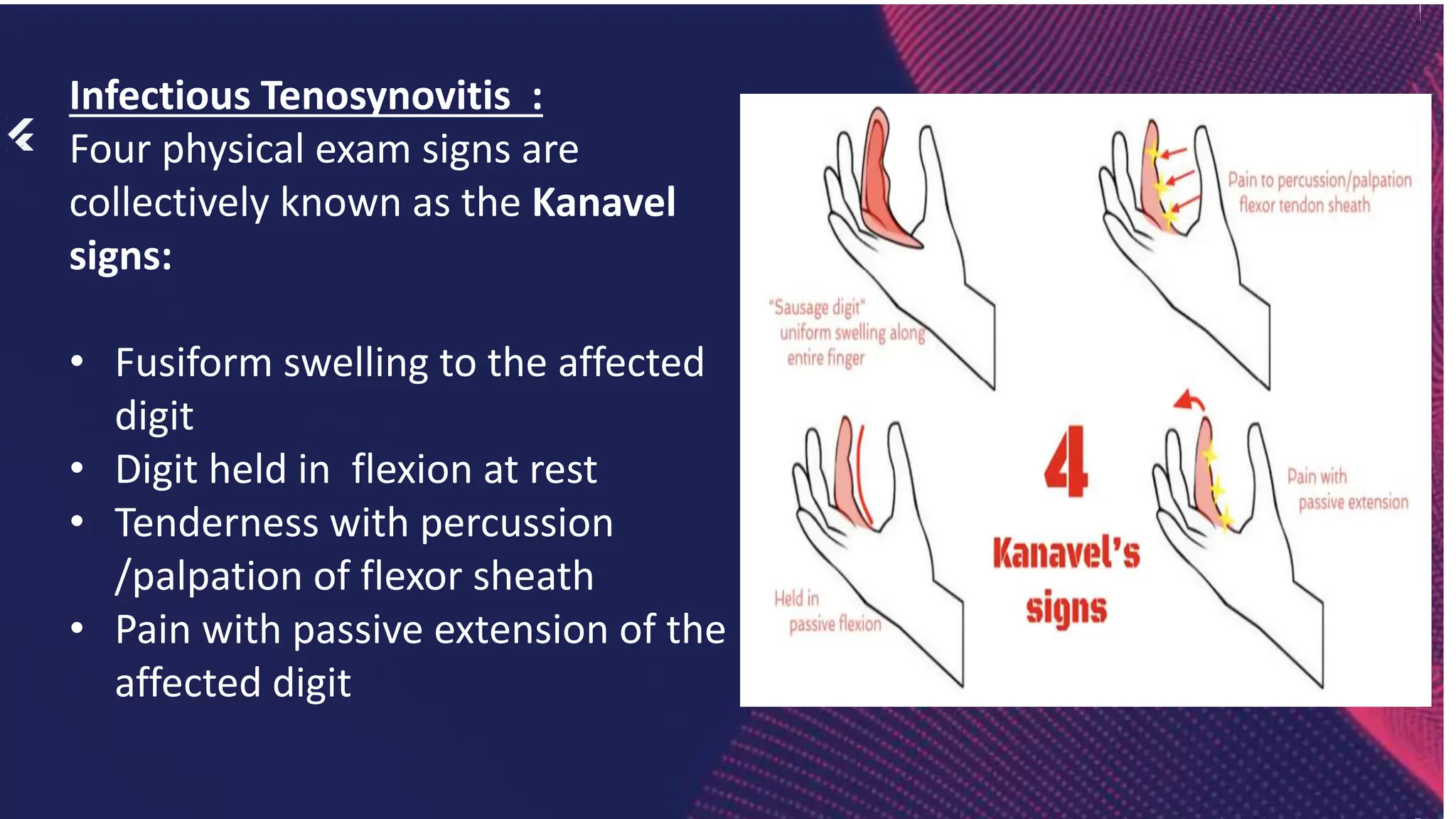 Musculoskeletal infection basics by capt alauddin.pptx