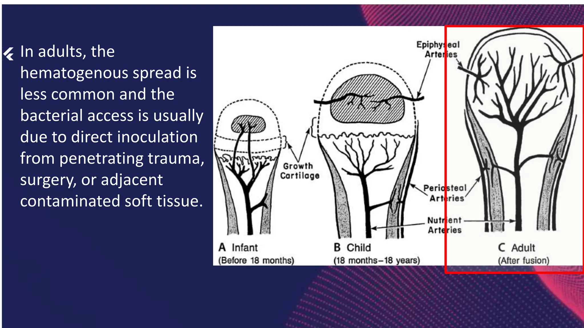 Musculoskeletal infection basics by capt alauddin.pptx