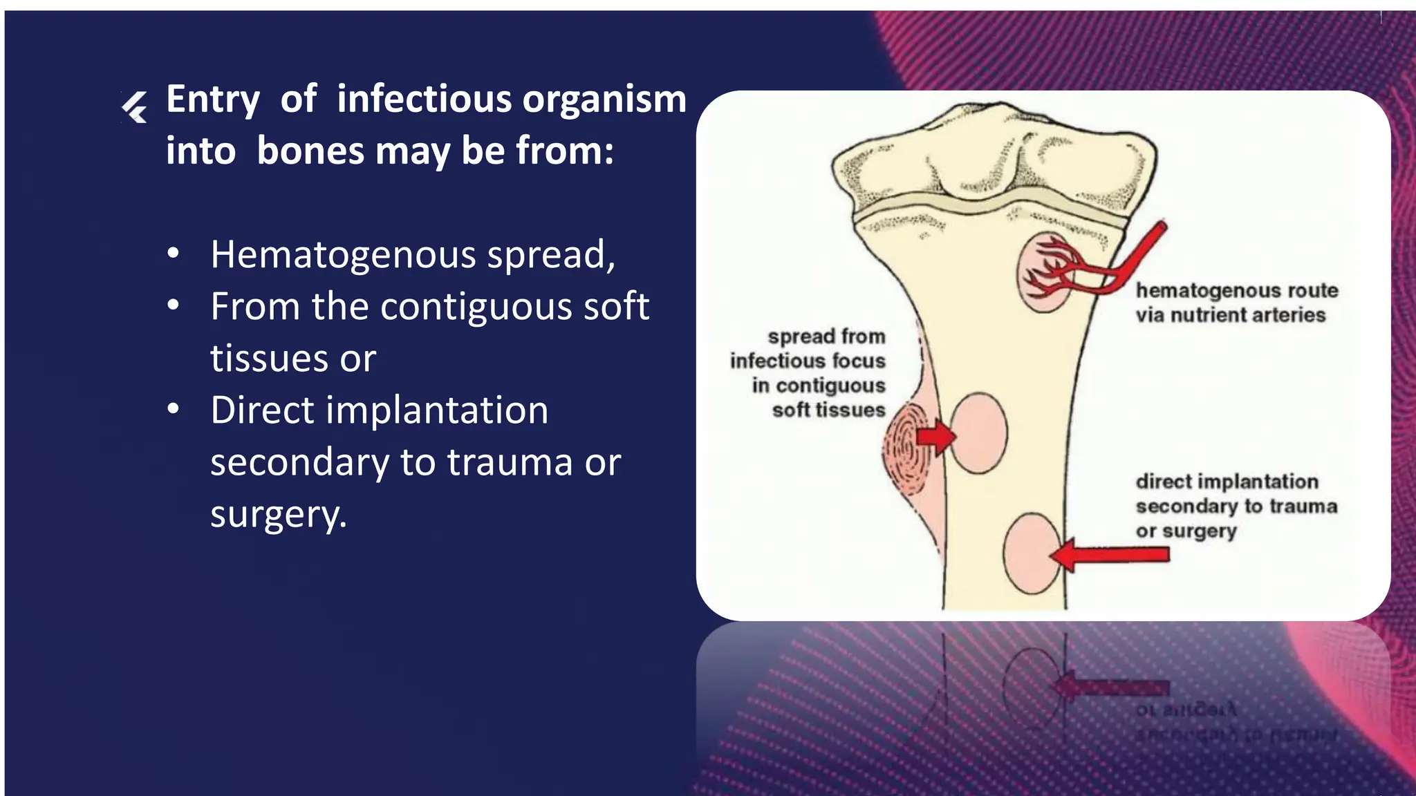 Musculoskeletal infection by capt alauddin.pptx
