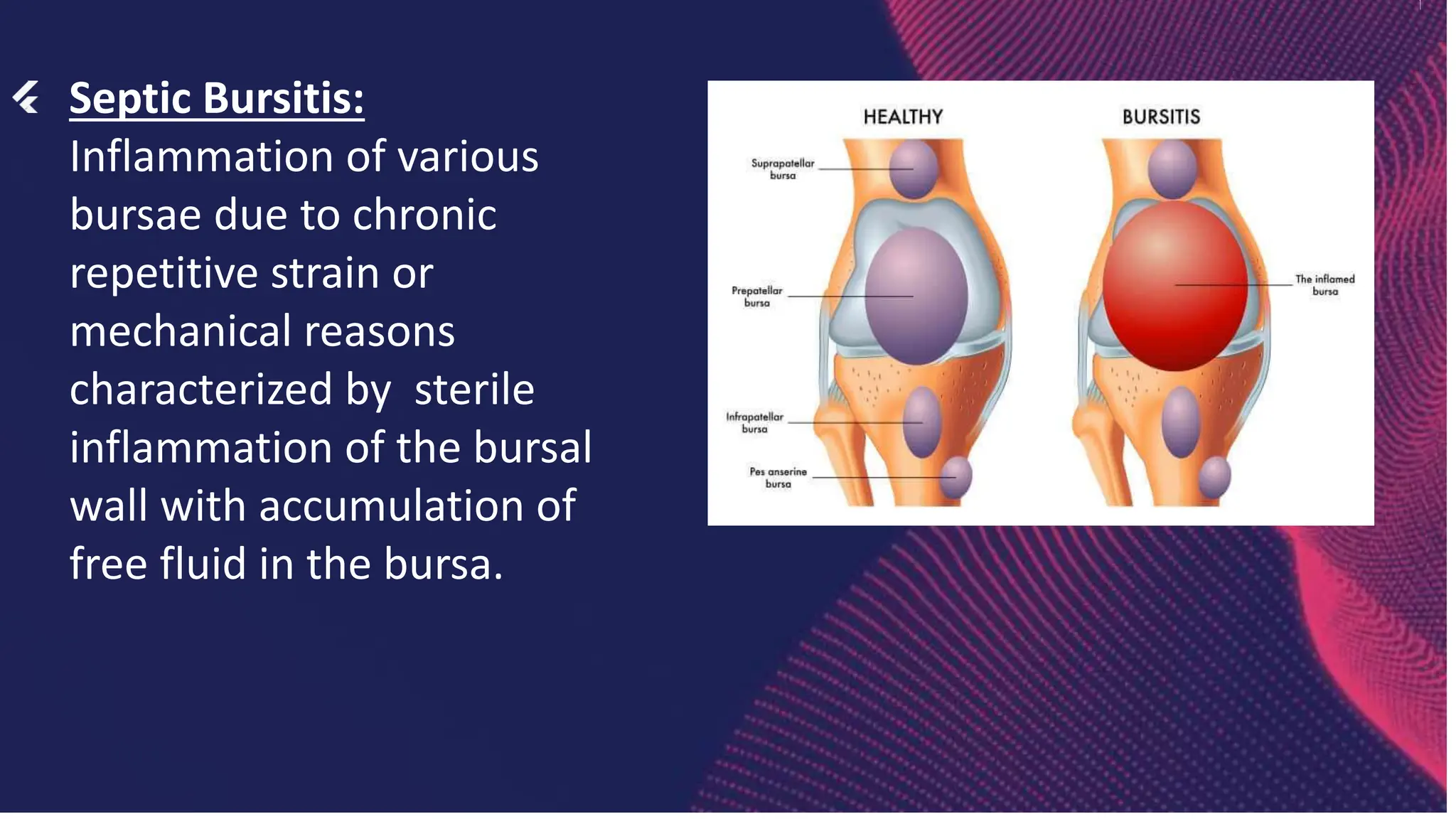 Musculoskeletal infection by capt alauddin.pptx