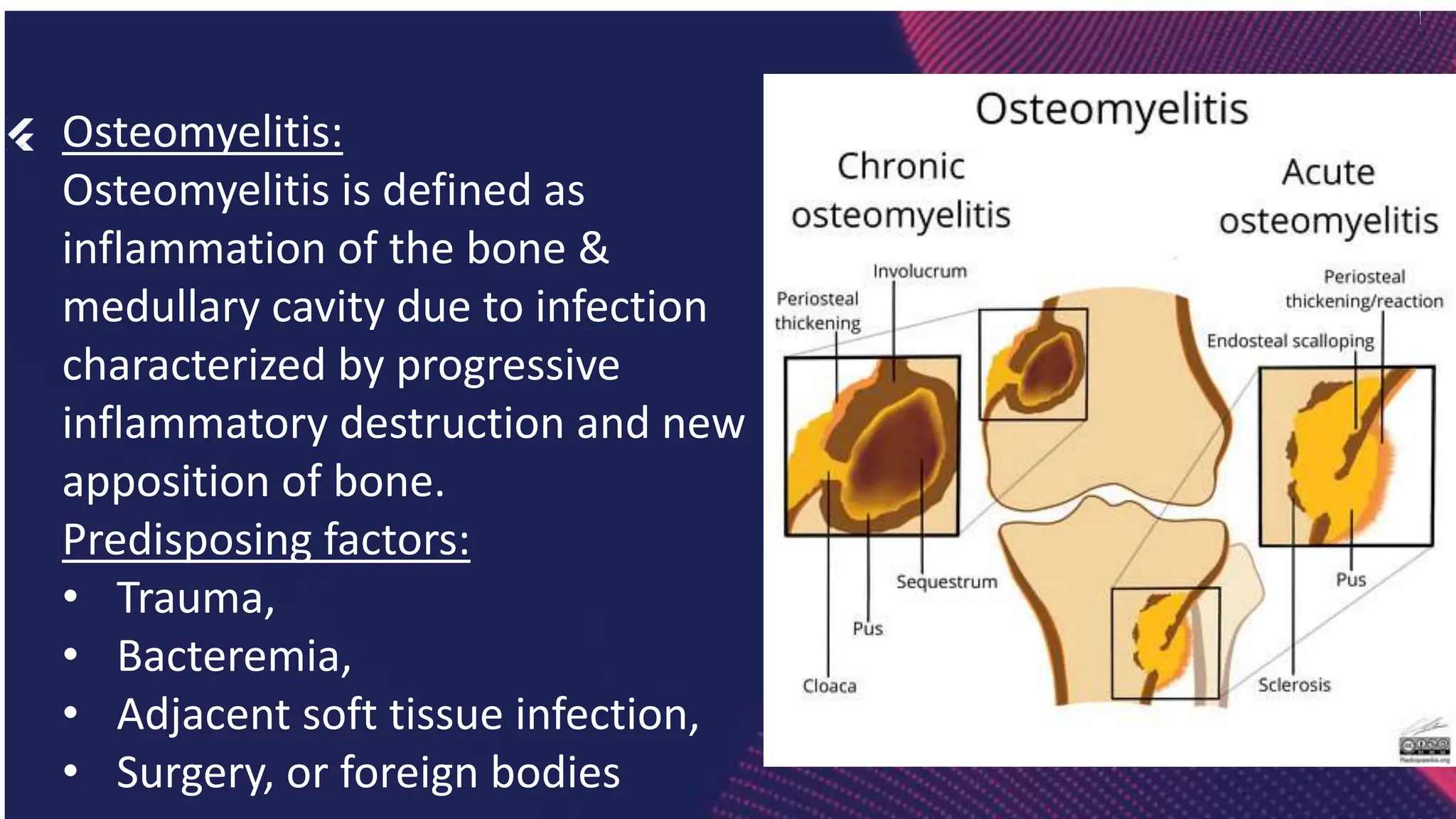 Musculoskeletal infection by capt alauddin.pptx