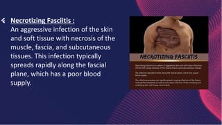 Musculoskeletal infection by capt alauddin.pptx