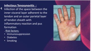 Musculoskeletal infection by capt alauddin.pptx