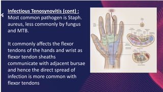Musculoskeletal infection by capt alauddin.pptx