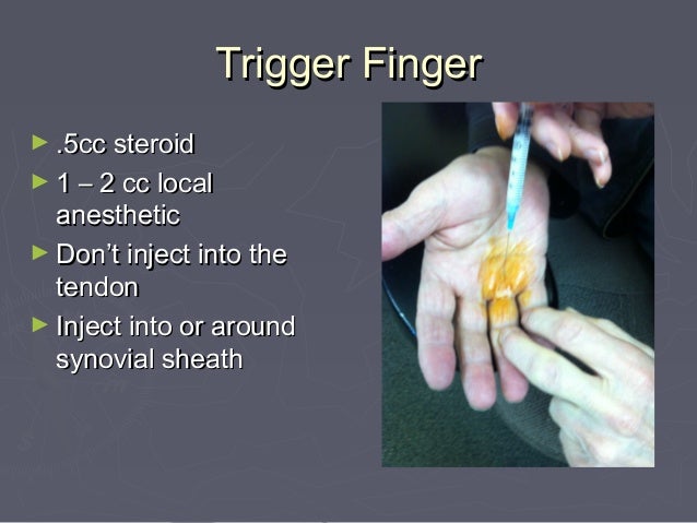 Musculoskeletal injections