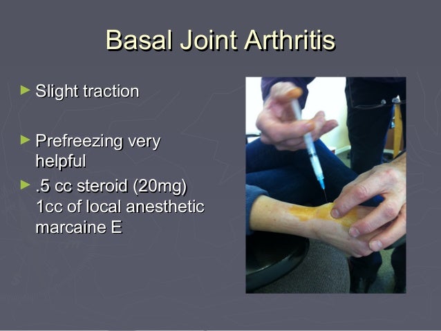 Musculoskeletal injections