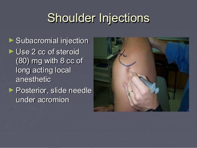 Musculoskeletal injections
