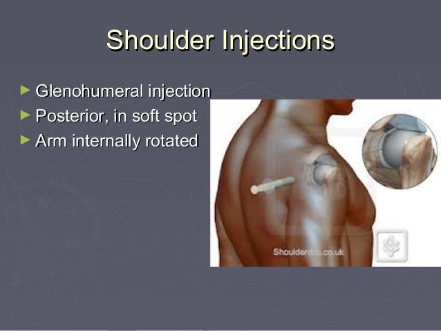 Musculoskeletal injections