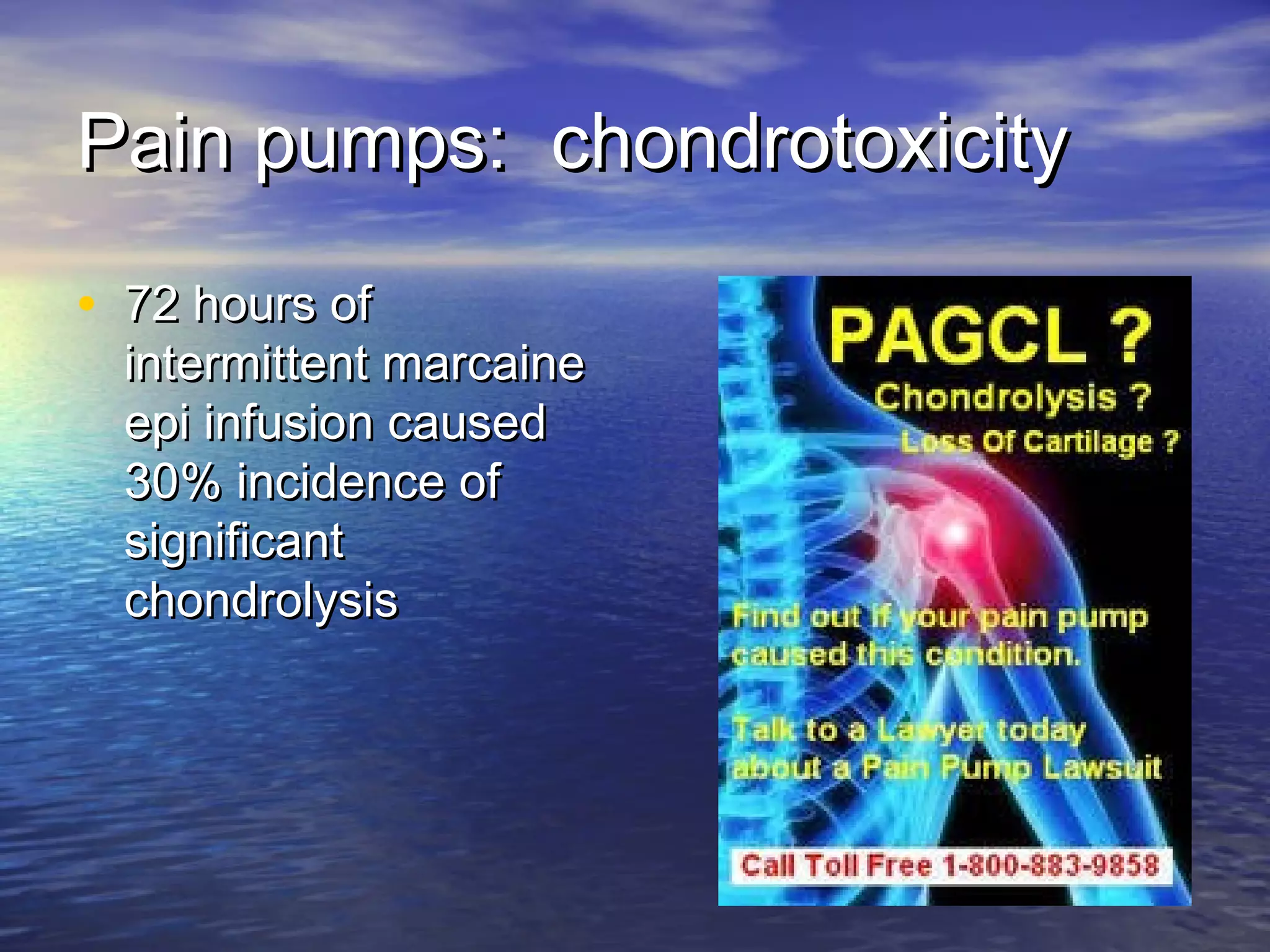 Musculoskeletal injections | PPT