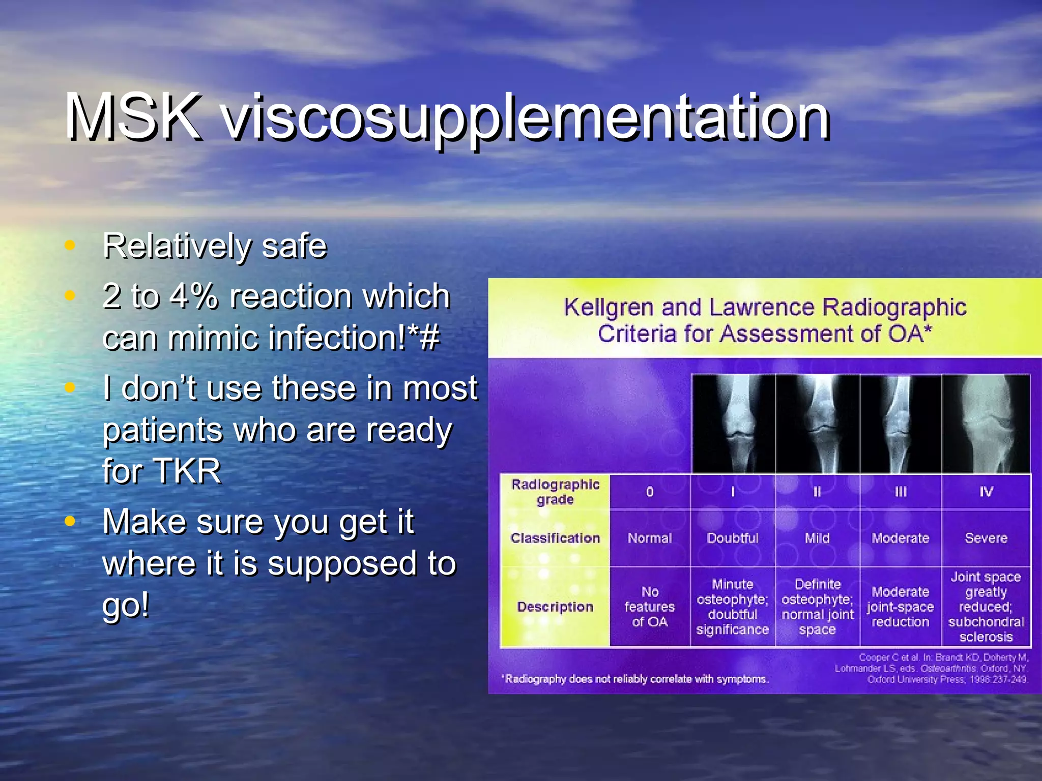 Musculoskeletal injections | PPT