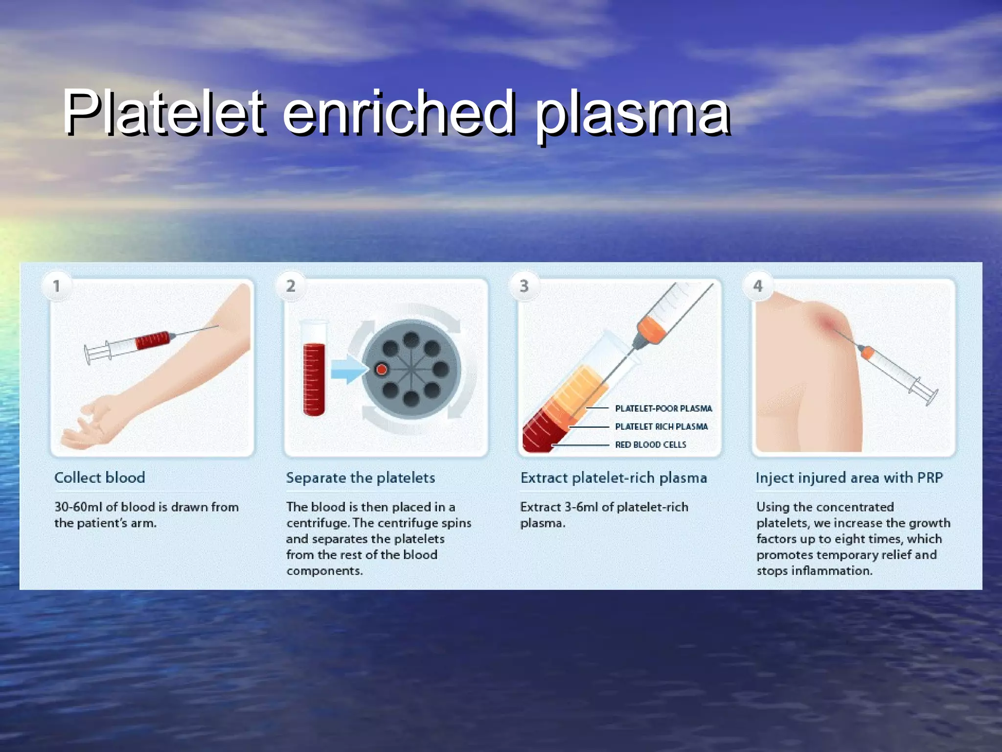 Musculoskeletal injections | PPT