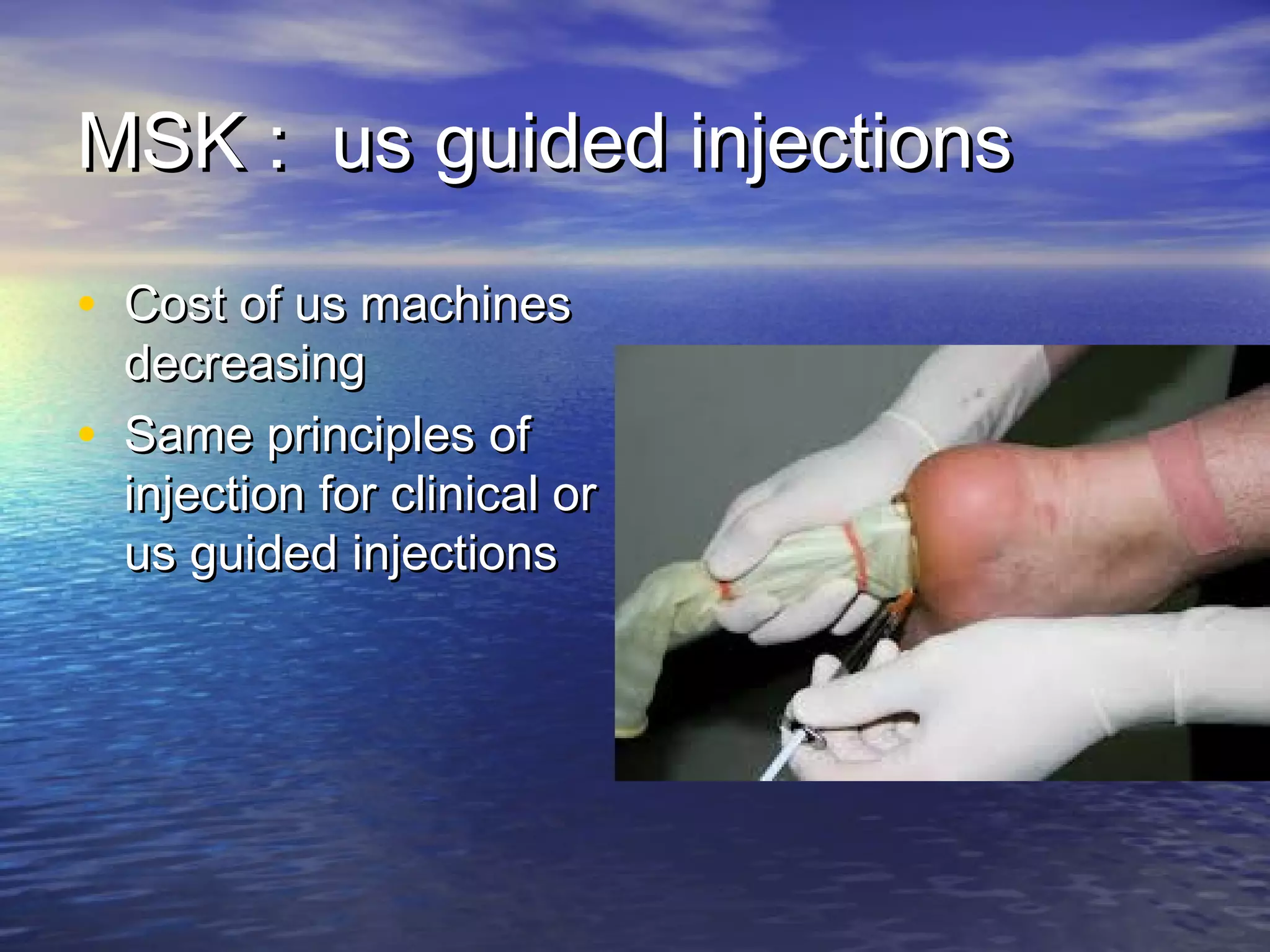 Musculoskeletal injections | PPT