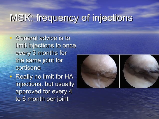 Musculoskeletal injections | PPT