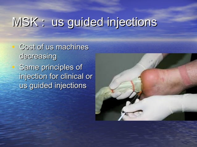 Musculoskeletal injections | PPT
