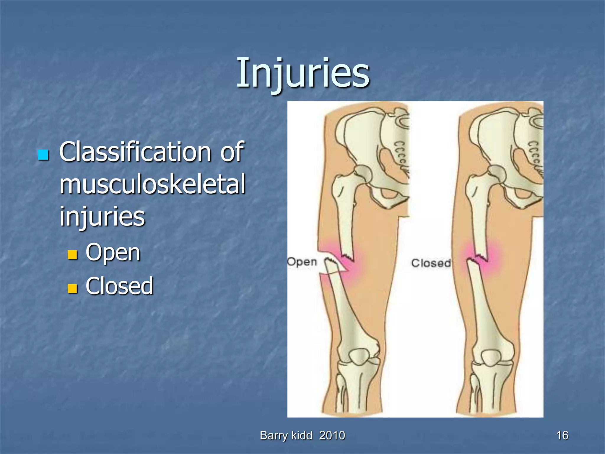 Musculoskeletal injuries | PPT