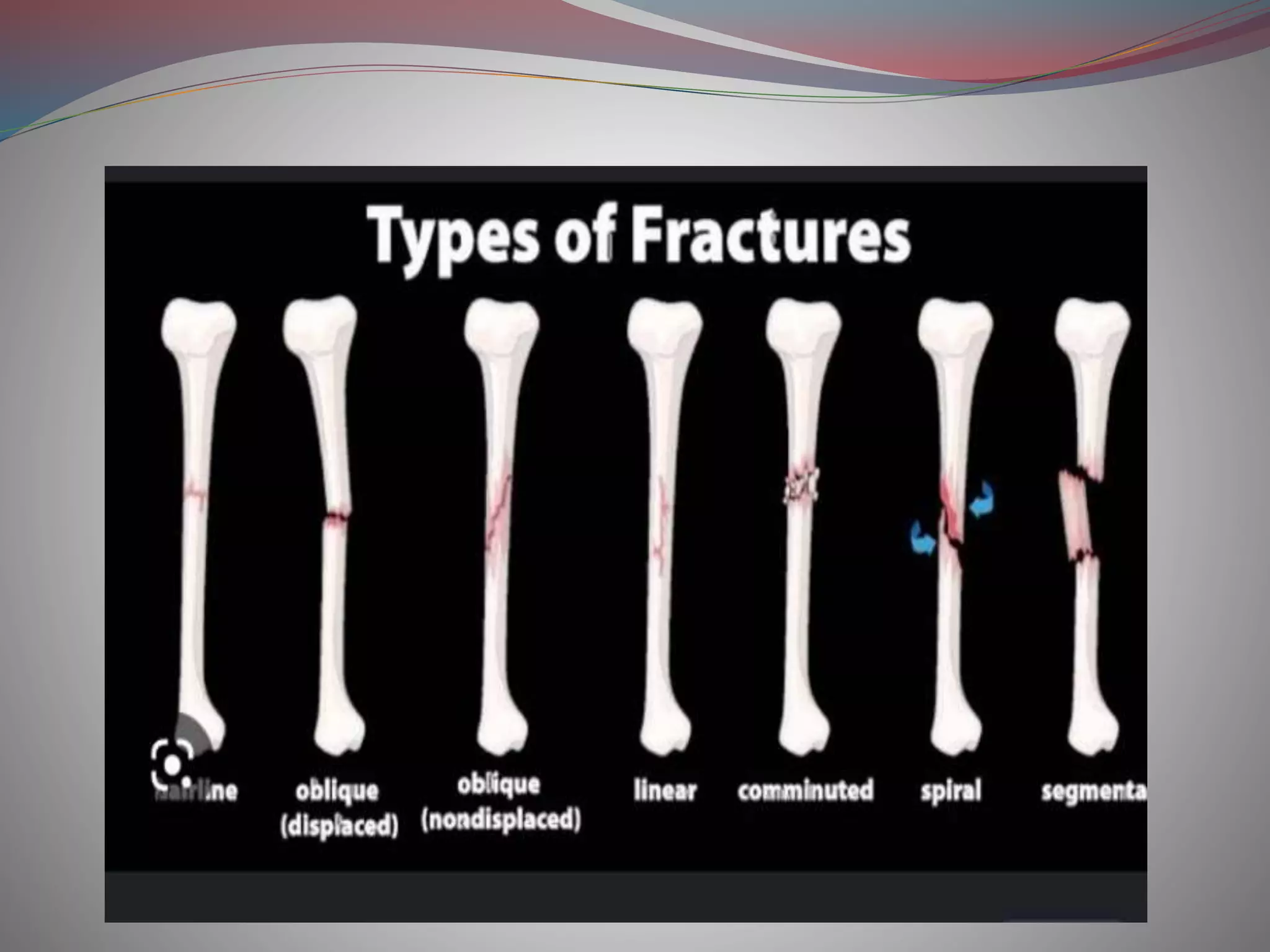 Musculoskeletal injury.pptx