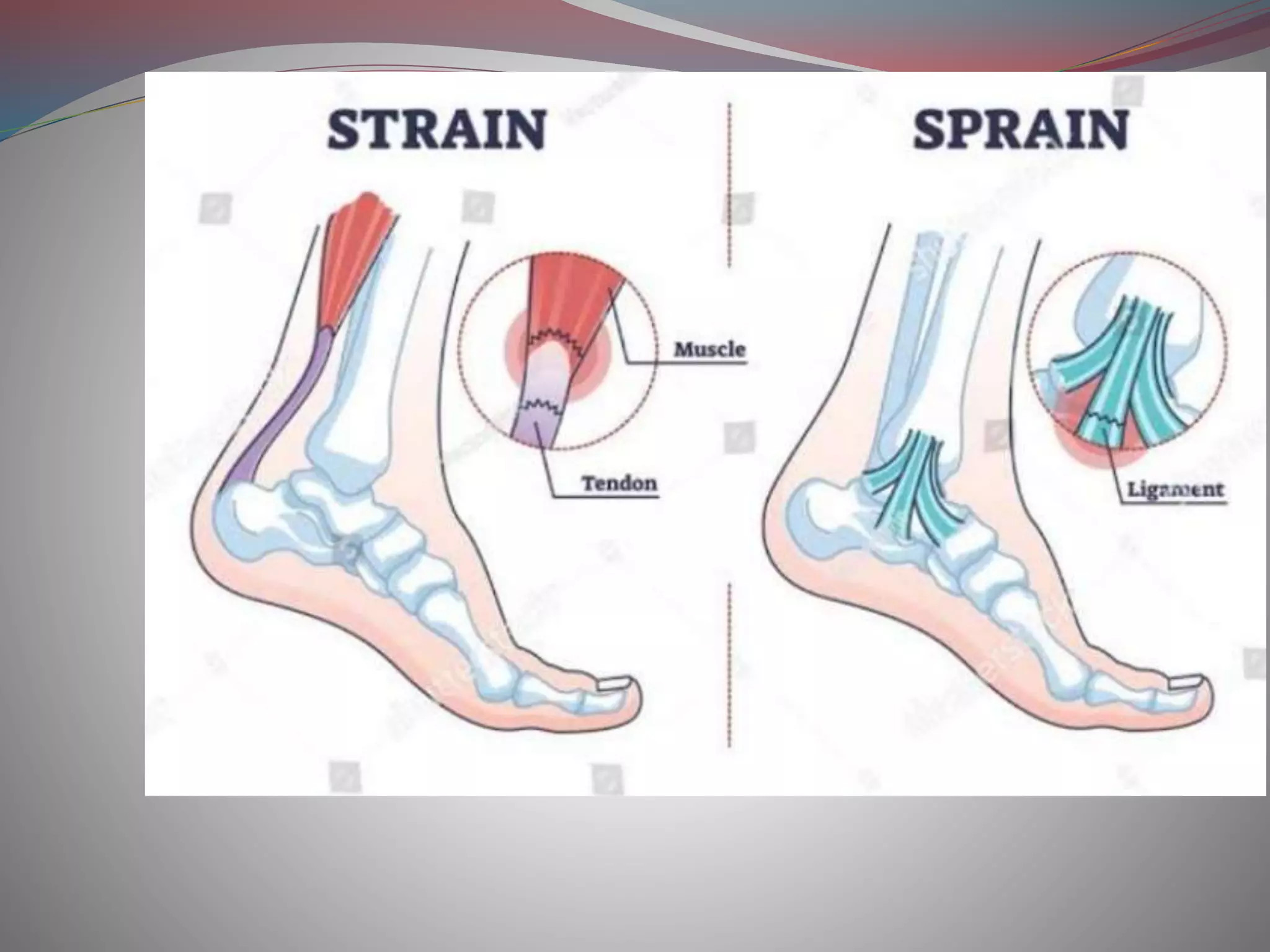 Musculoskeletal injury.pptx