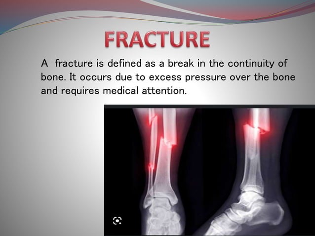 Musculoskeletal injury.pptx | First Aid | Injuries