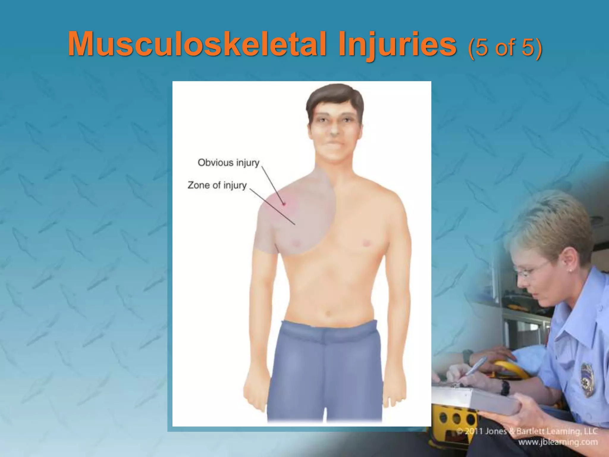 MUSCULOSKELETAL INJURY.ppt | Death, Injury, or Military Conflict ...