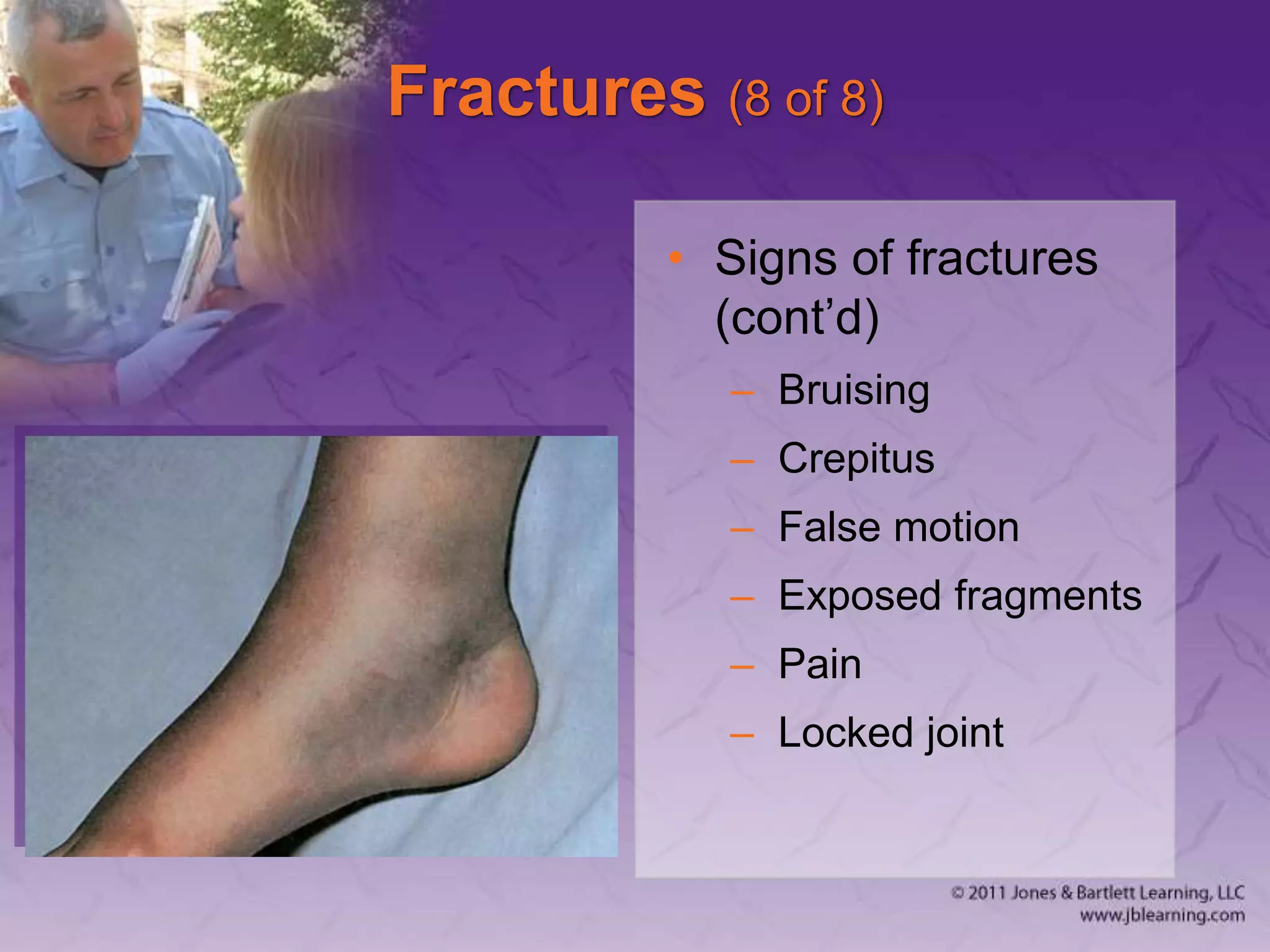 MUSCULOSKELETAL INJURY.ppt