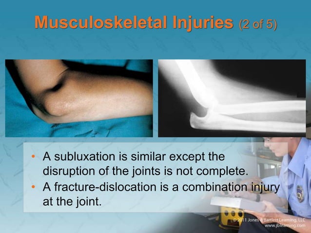 MUSCULOSKELETAL INJURY.ppt | Death, Injury, or Military Conflict ...