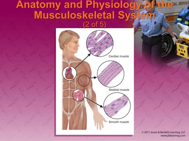 MUSCULOSKELETAL INJURY.ppt | Death, Injury, or Military Conflict ...