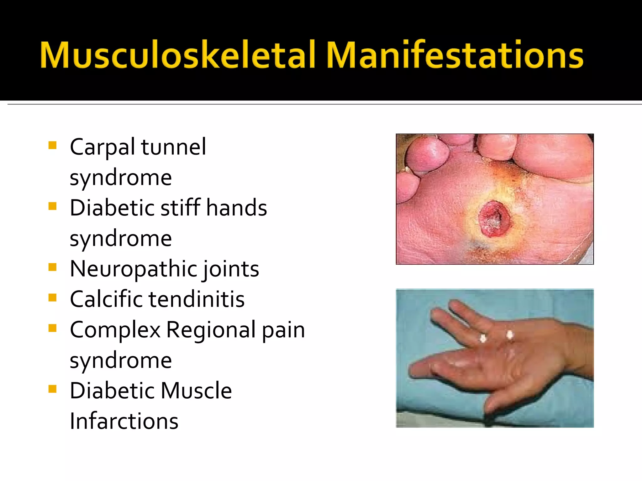 Musculoskeletal manifestations of diabetes mellitus | PPT