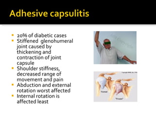 Musculoskeletal manifestations of diabetes mellitus | PPT