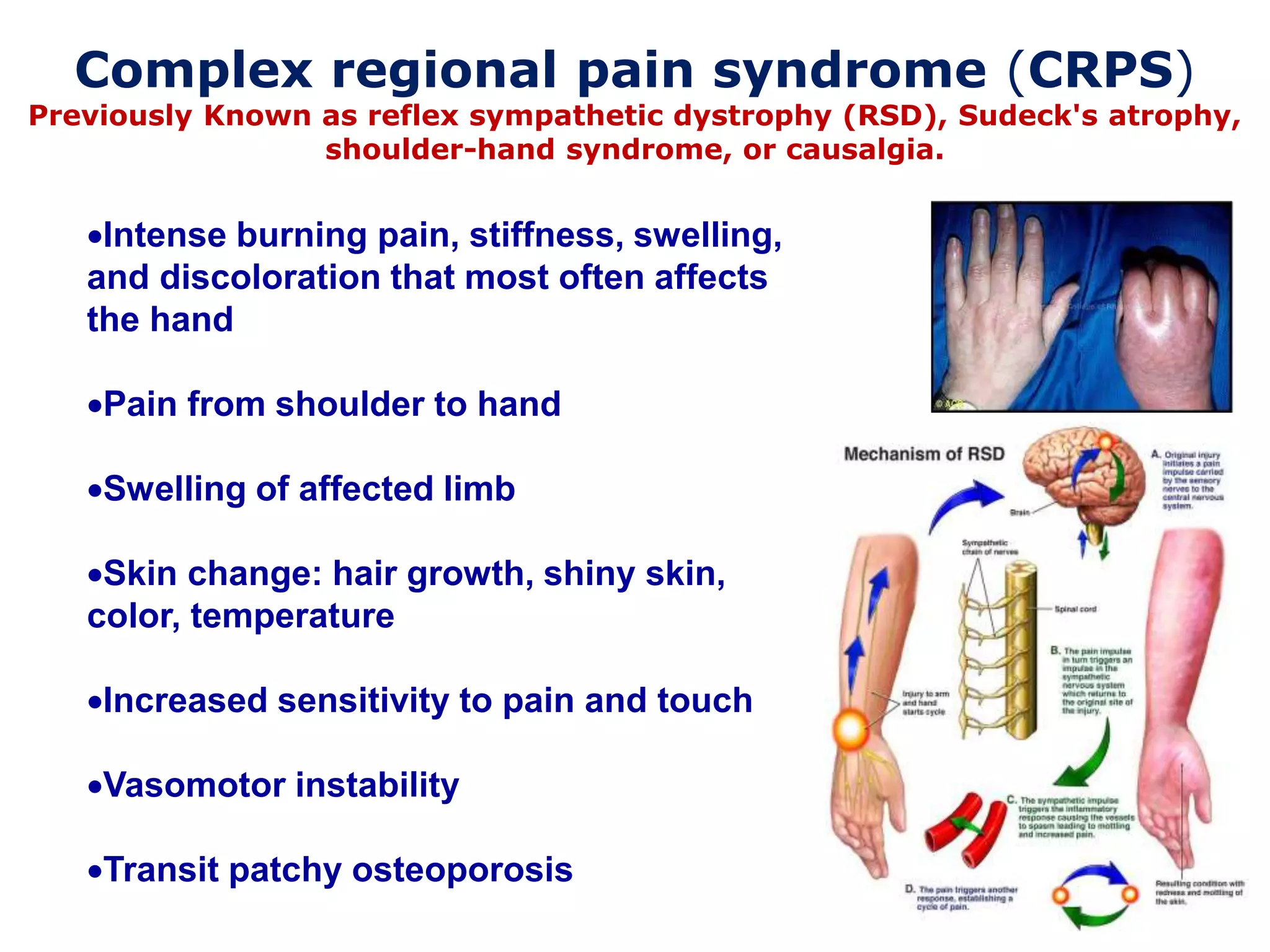 Musculoskeletal manifestations of diabetes mellitus | PPTX