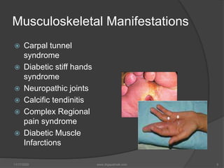 Musculoskeletal manifestations of_diabetes_mellitus | PPT