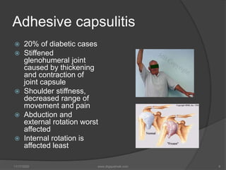 Musculoskeletal manifestations of_diabetes_mellitus | PPT