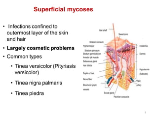 Musculoskeletal mycosis 2024(1).GGGYGpdf | PDF
