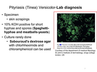 Musculoskeletal mycosis 2024(1).GGGYGpdf | PPT