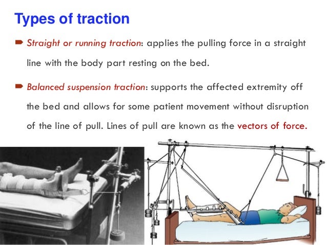 Musculoskeletal nursing
