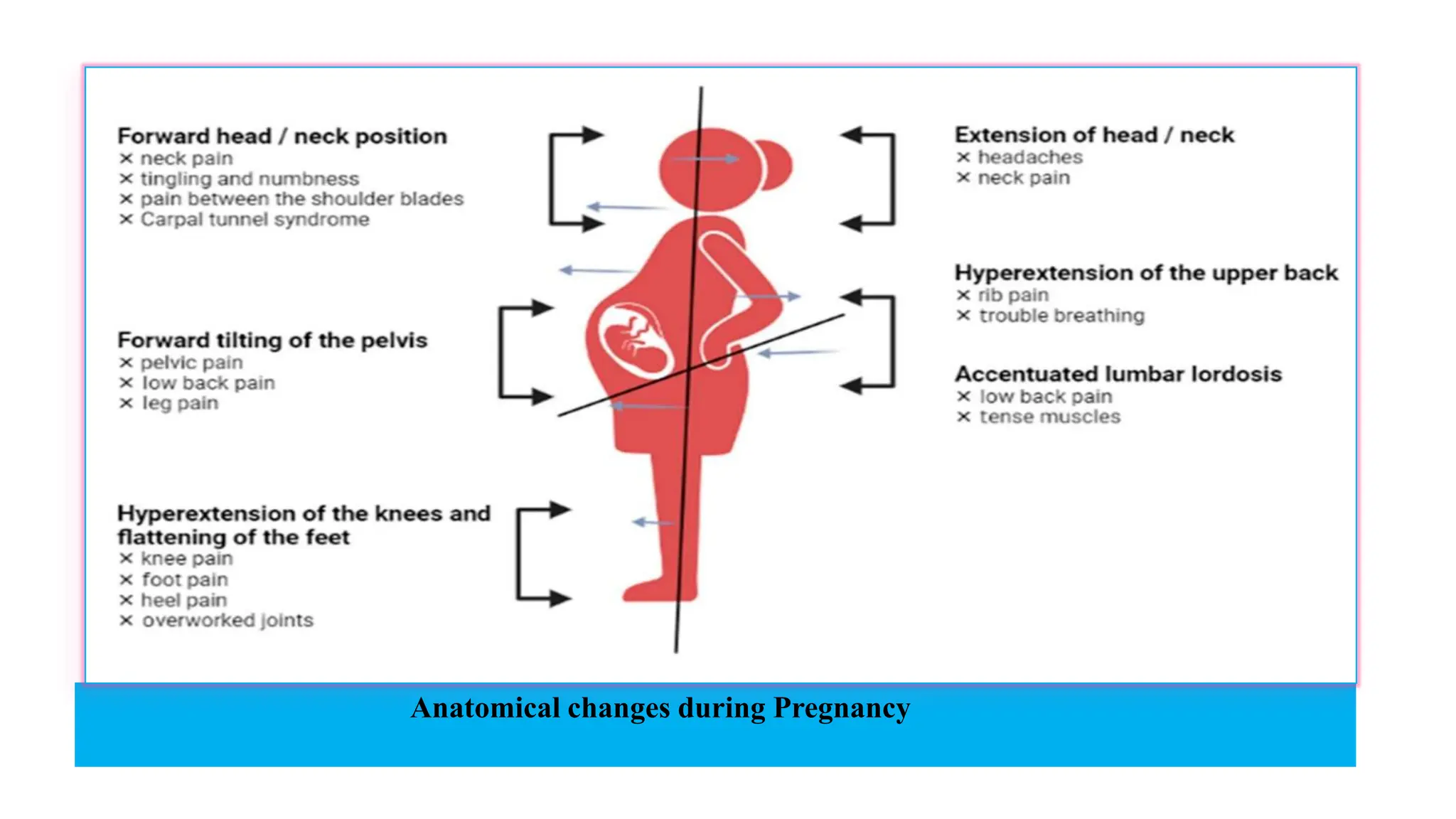 Musculoskeletal Problem in Obstetrics.pptx