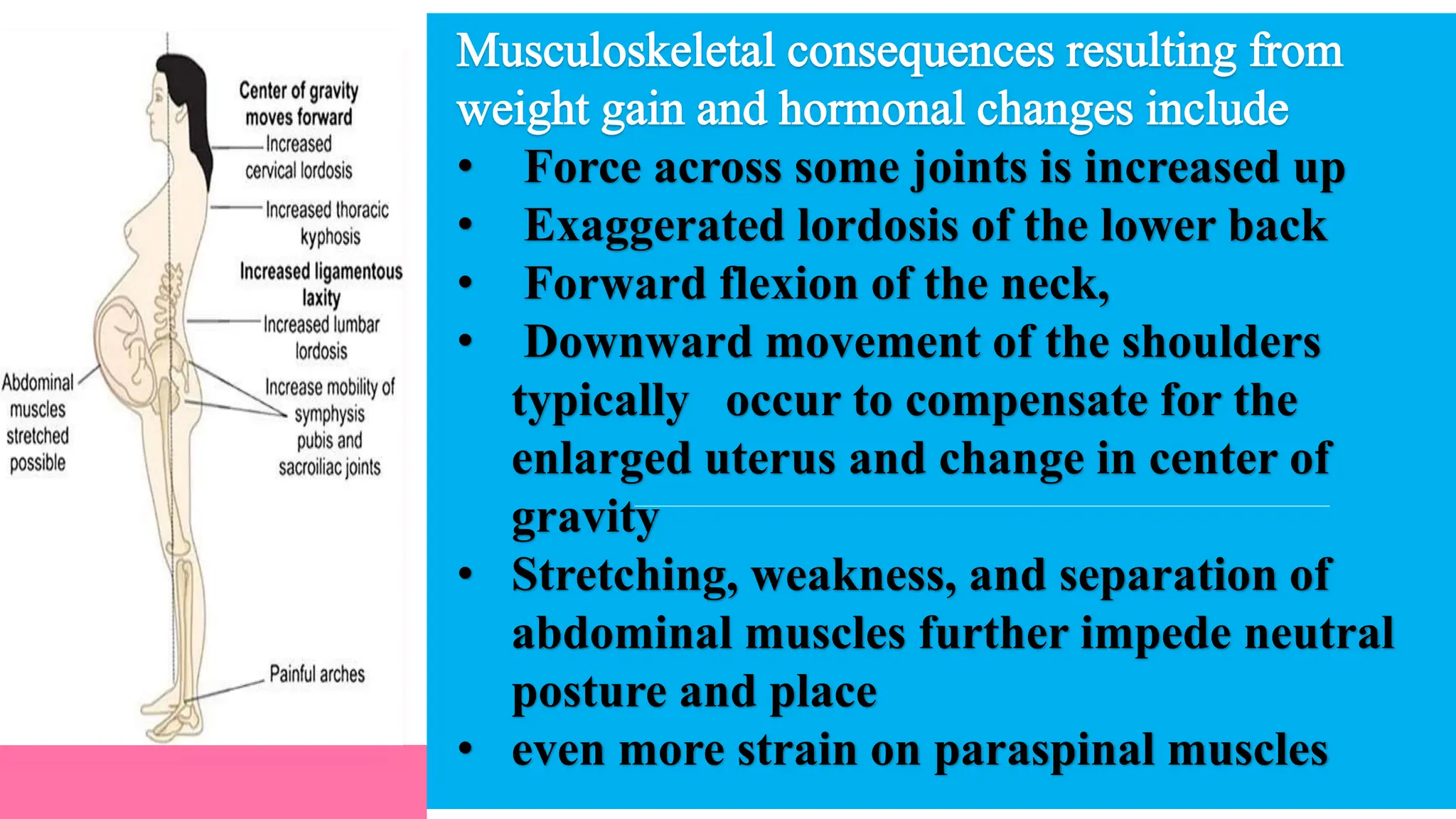 Musculoskeletal Problem in Obstetrics.pptx