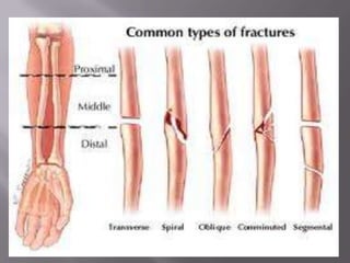Musculoskeletal system | PPTX