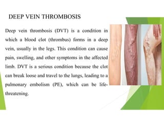COMPLICATION OF MUSCULOSKELETAL SYSTEM . | PPTX