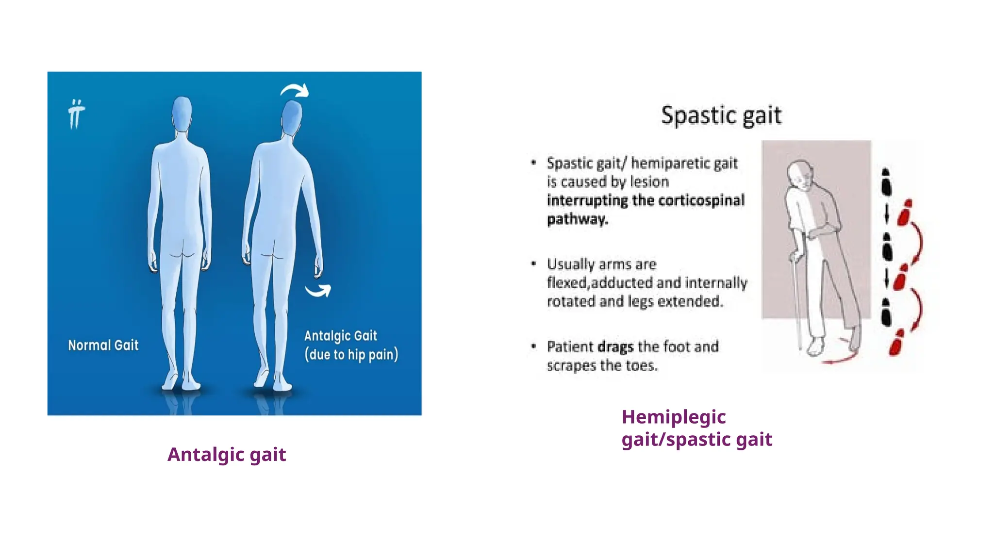 Musculoskeletal system-GALS screening.pptx