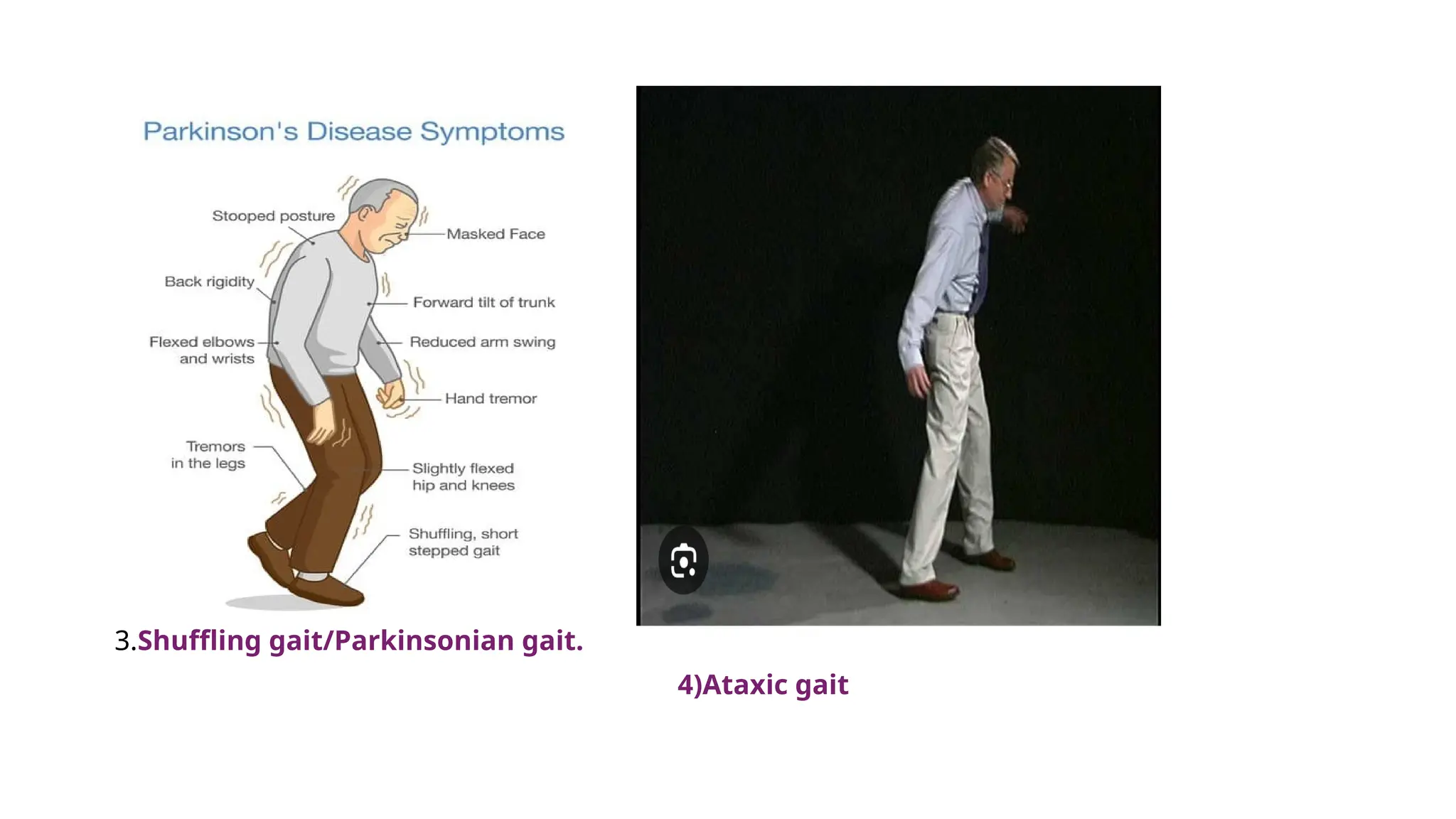 Musculoskeletal system-GALS screening.pptx