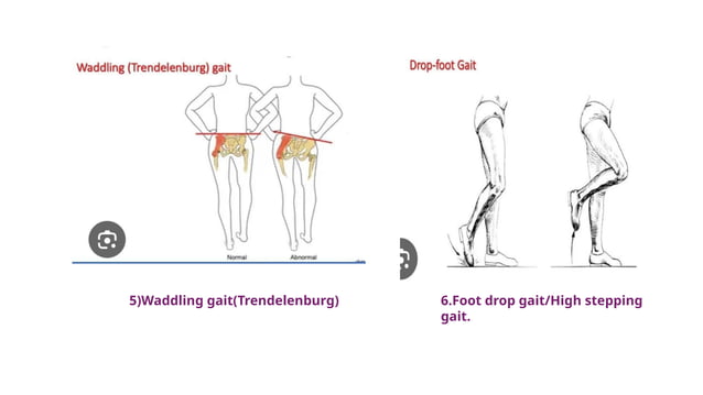 Musculoskeletal system-GALS screening.pptx