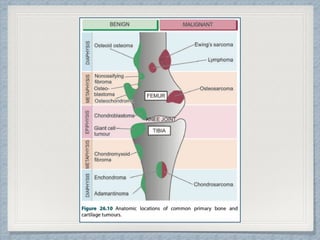 Musculoskeletal system TUMORS pathology .pptx