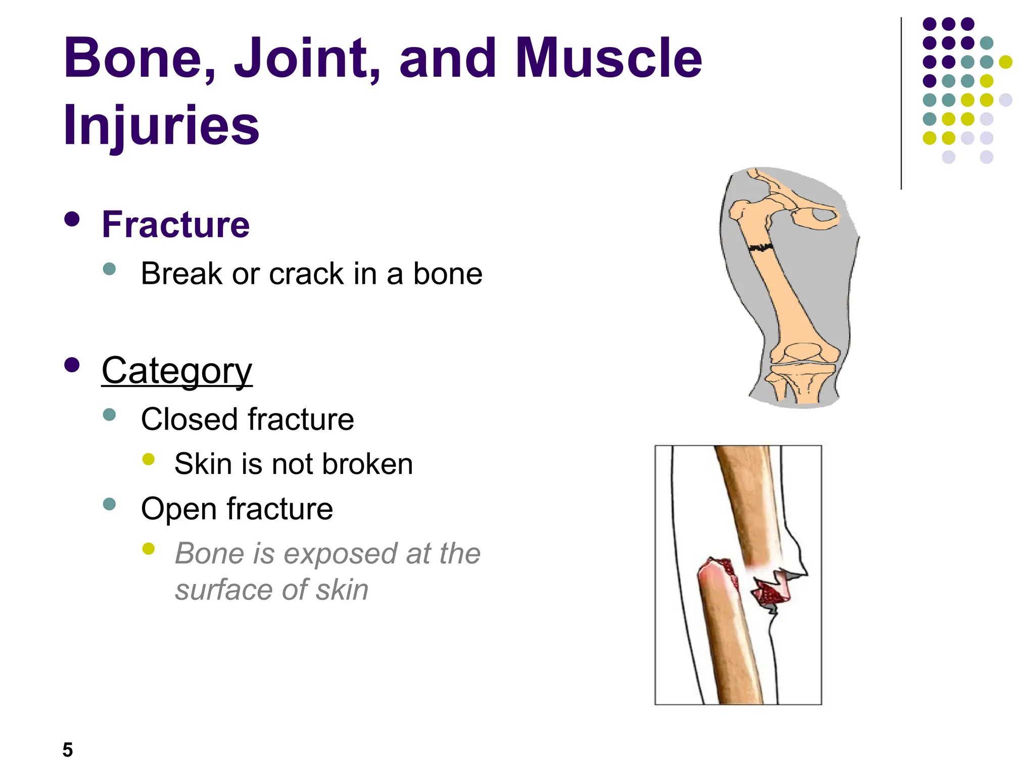 Musculo skeletal trauma. Bone, Joint, and Muscle Injuries | PPT