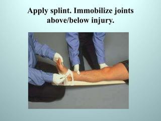 Musculoskeletal trauma - dr. Hendy .ppt